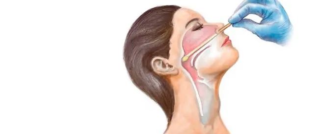 PCR: Qué es, en qué consiste el PCR test o examen PCR del COVID19